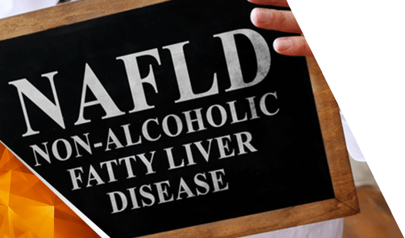 Causes and treatment to handle Non Alcoholic Fatty Liver Disease (NAFLD)